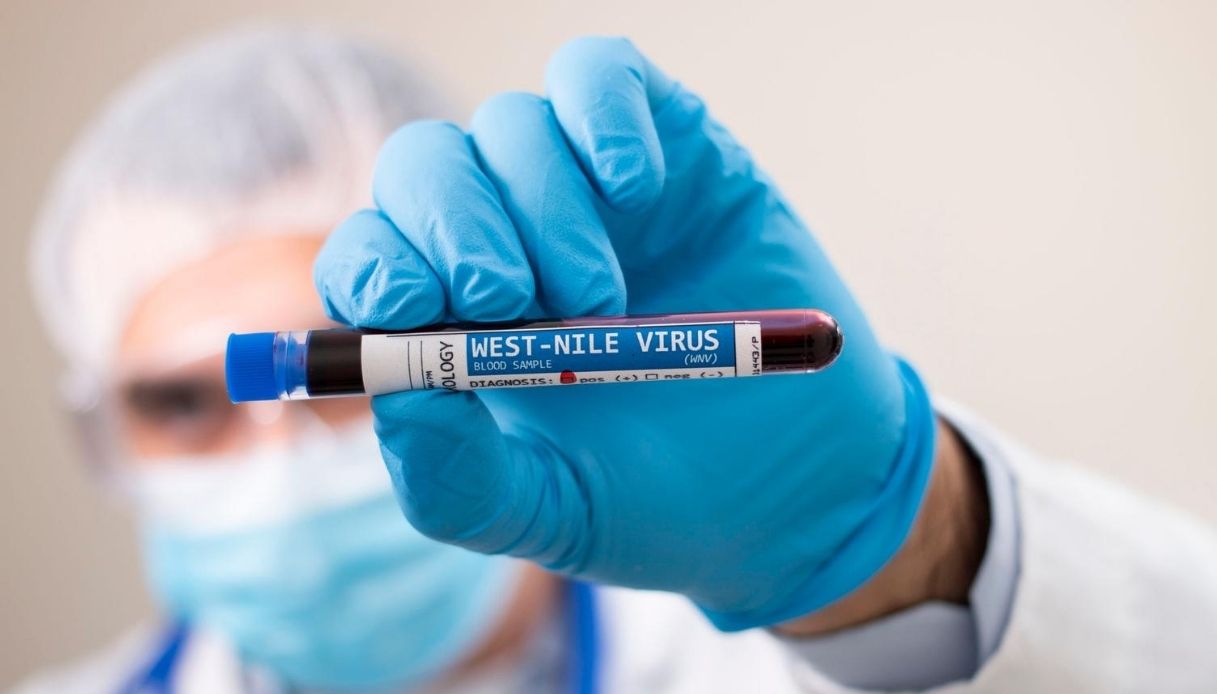 Febbre del Nilo, aumentano a 13 le persone ricoverate a Lodi