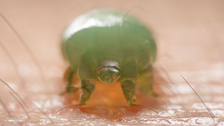 Cagliari, scabbia in una scuola: chiuso il liceo artistico Fois. Cos'è ...