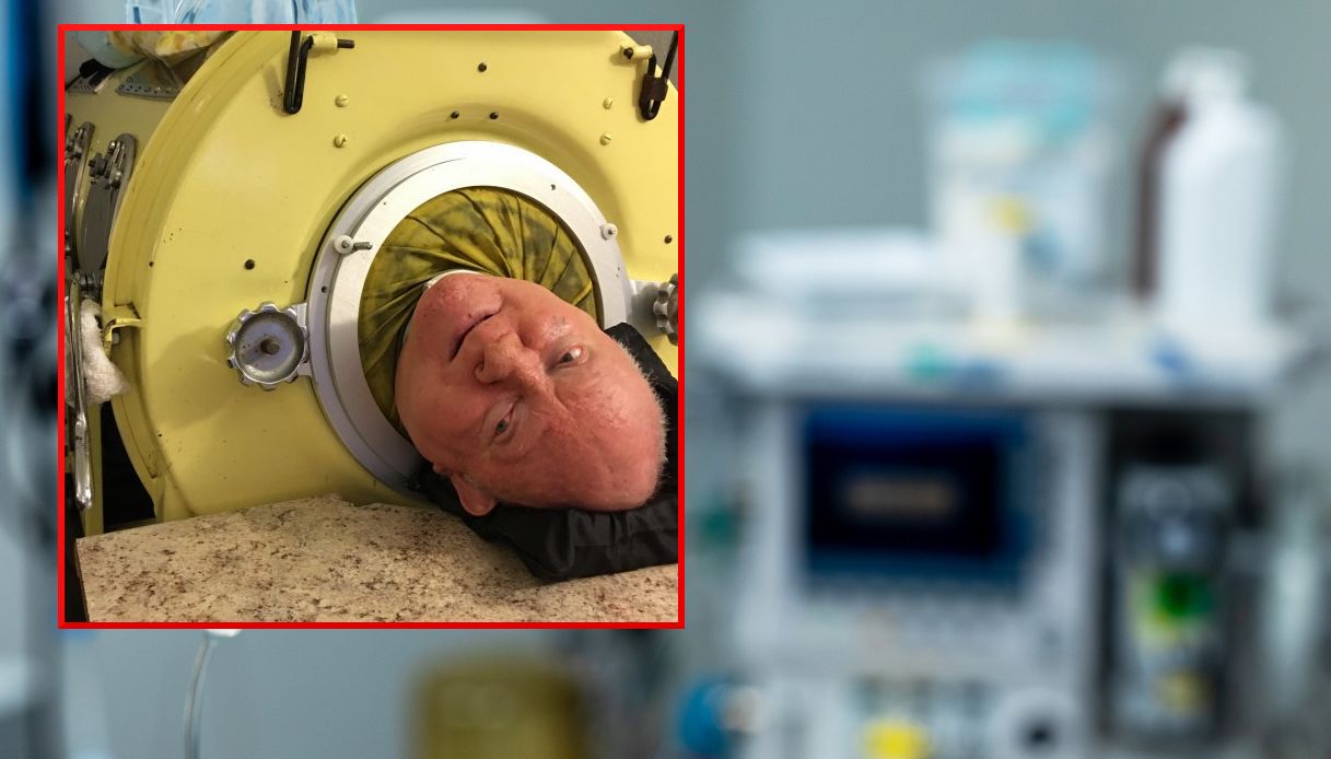 Paul Alexander morto nel polmone d'acciaio dopo averci vissuto 70 anni ...