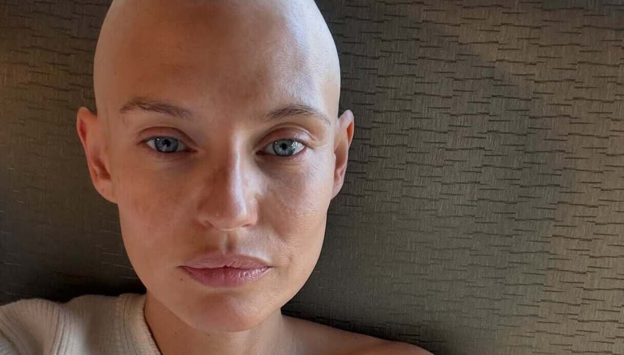 Bianca Balti infiamma Sanremo: "Col cancro i brand hanno smesso di lavorare con me, ora mostro ...