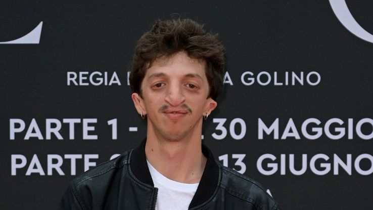 L'attore Giovanni Bagnasco affetto dalla sindrome di Treacher Collins ...