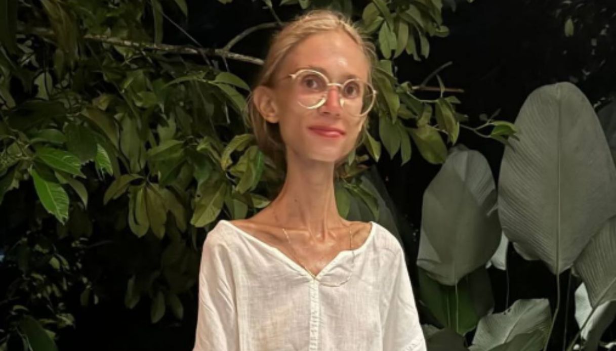 Influencer Karolina Krzyzak trovata morta a Bali, aveva un disturbo alimentare e seguiva una ...