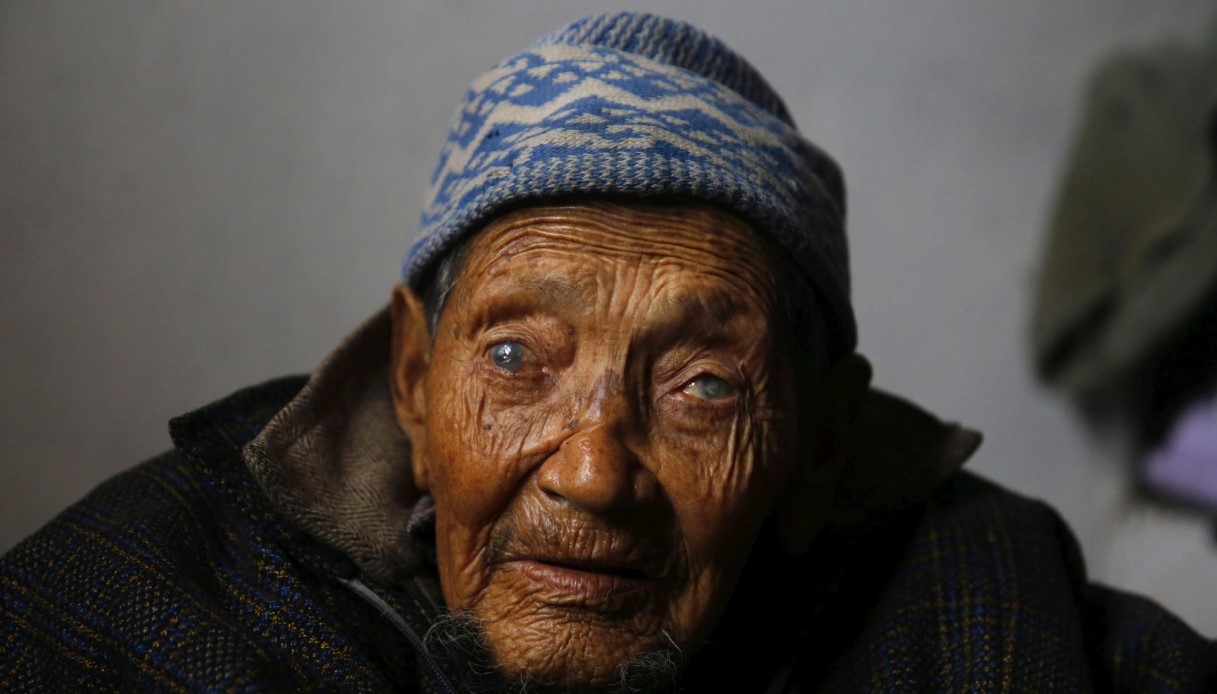 Lebbra Romania, due casi accertati a Cluj e altri due sospetti: sono donne che lavorano in un ...