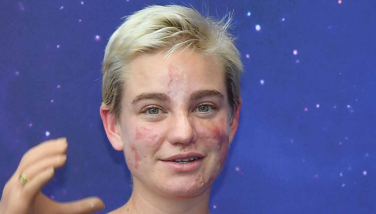 Bebe Vio e la splendida lezione sui bambini: il ricordo all'asilo